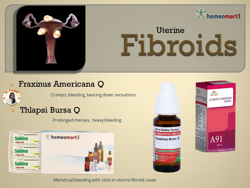 Homeopathic Uterine Fibroid Treatment - Expert Recommendations by Dr. K.S. Gopi & Dr. Pranjali ...