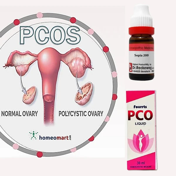 Buy Best Homeopathic Medicine for PCOS & Ovarian Cysts - HomeoMart ...