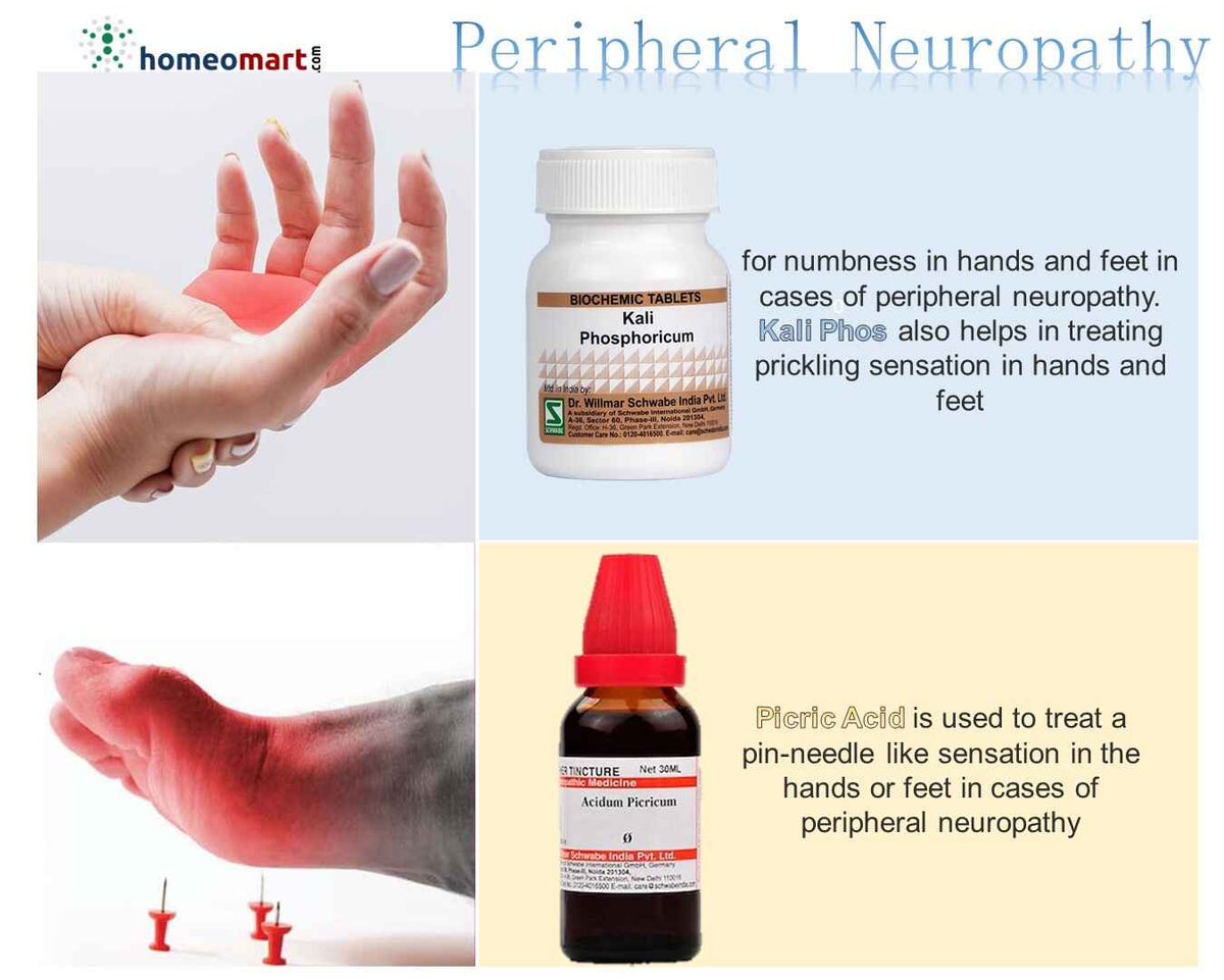 Natural Homeopathic Relief for Peripheral Neuropathy | Nerve Pain ...