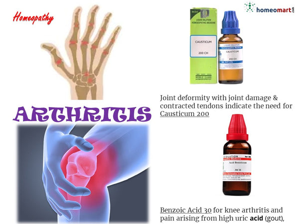 Arthritis of knee homeopathy medicines with indications. Doctor Rx ...