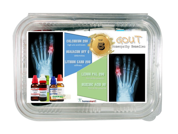 Top 5 gout treatment homeopathic medicines in drops and pills – Homeomart