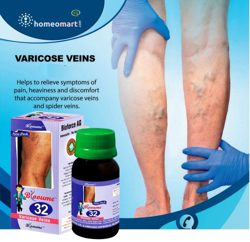Homeopathy Medicines for Varicose Veins Treatment | Effective & Safe ...