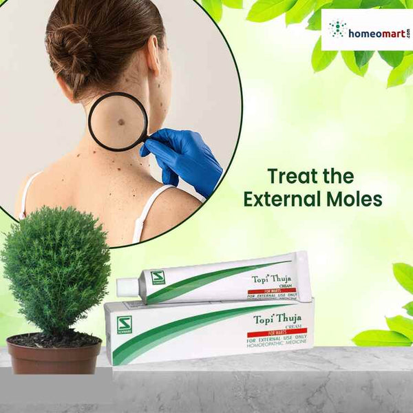 Schwabe Topi Thuja Cream - Effective Natural Wart Removal | Homeopathy ...