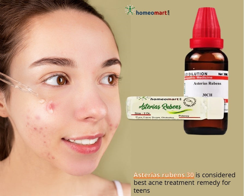Best homeopathy medicines for acne by indications in pills, drops ...