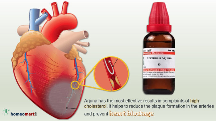 Homeopathic Remedies for Heart Health | Natural Cardiac Care Solutions ...