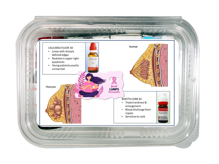 Homeopathy medicines for breast lumps, tumors underdeveloped breasts – Homeomart