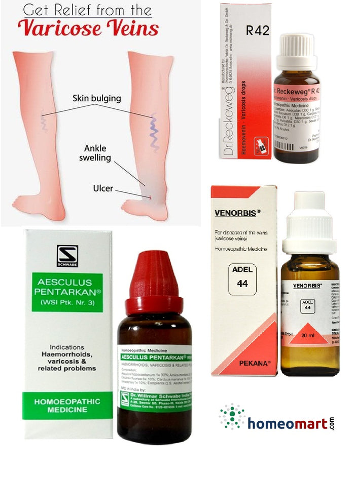Homeopathy Medicines for Varicose Veins Treatment | Effective & Safe ...